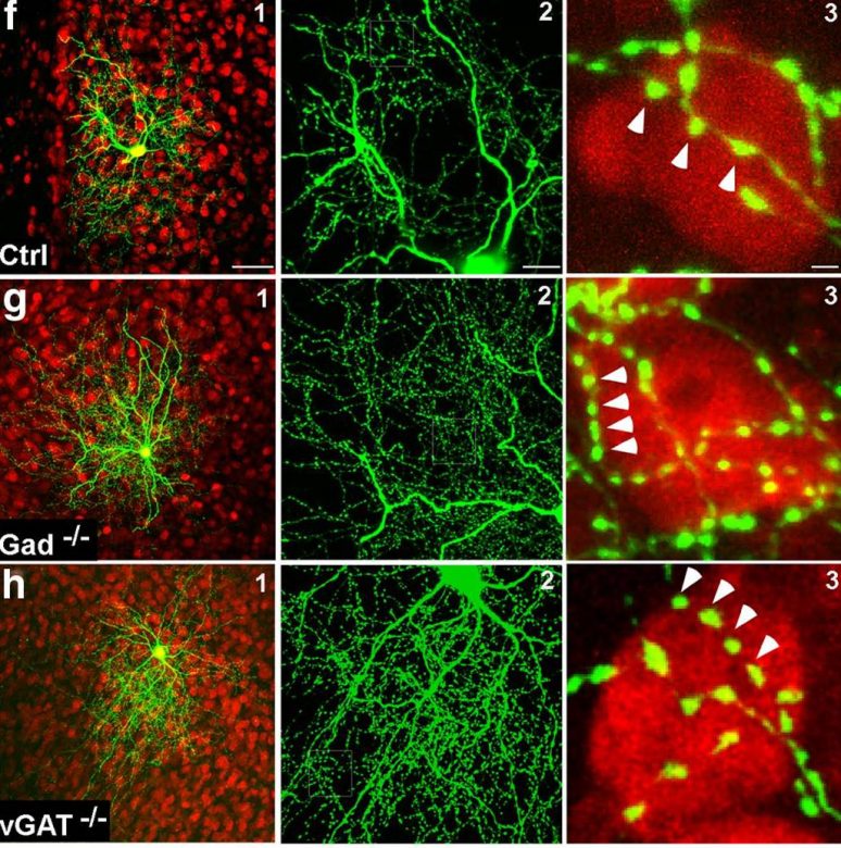 GABA signaling prunes back copious ‘provisional’ synapses during neural ...