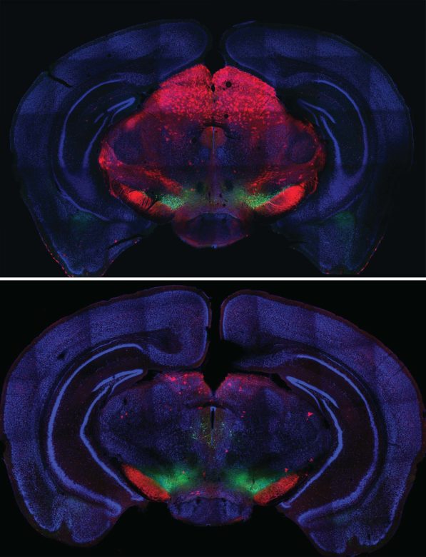 The miracle of brain development | Cold Spring Harbor Laboratory