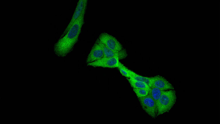 Inspiring breast cancer breakthroughs | Cold Spring Harbor Laboratory